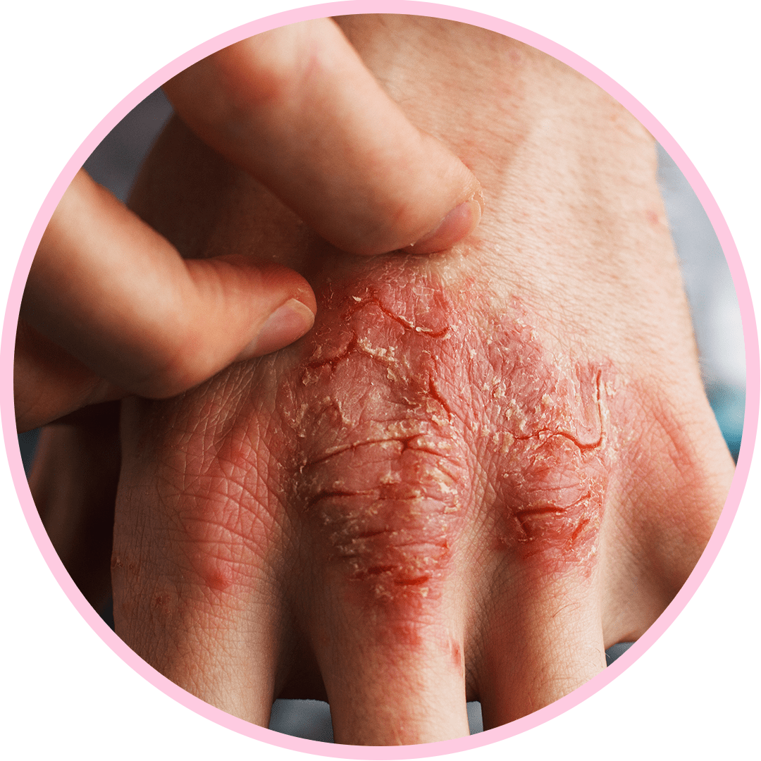 Delhicious - Award Winning Natural Skin Solutions