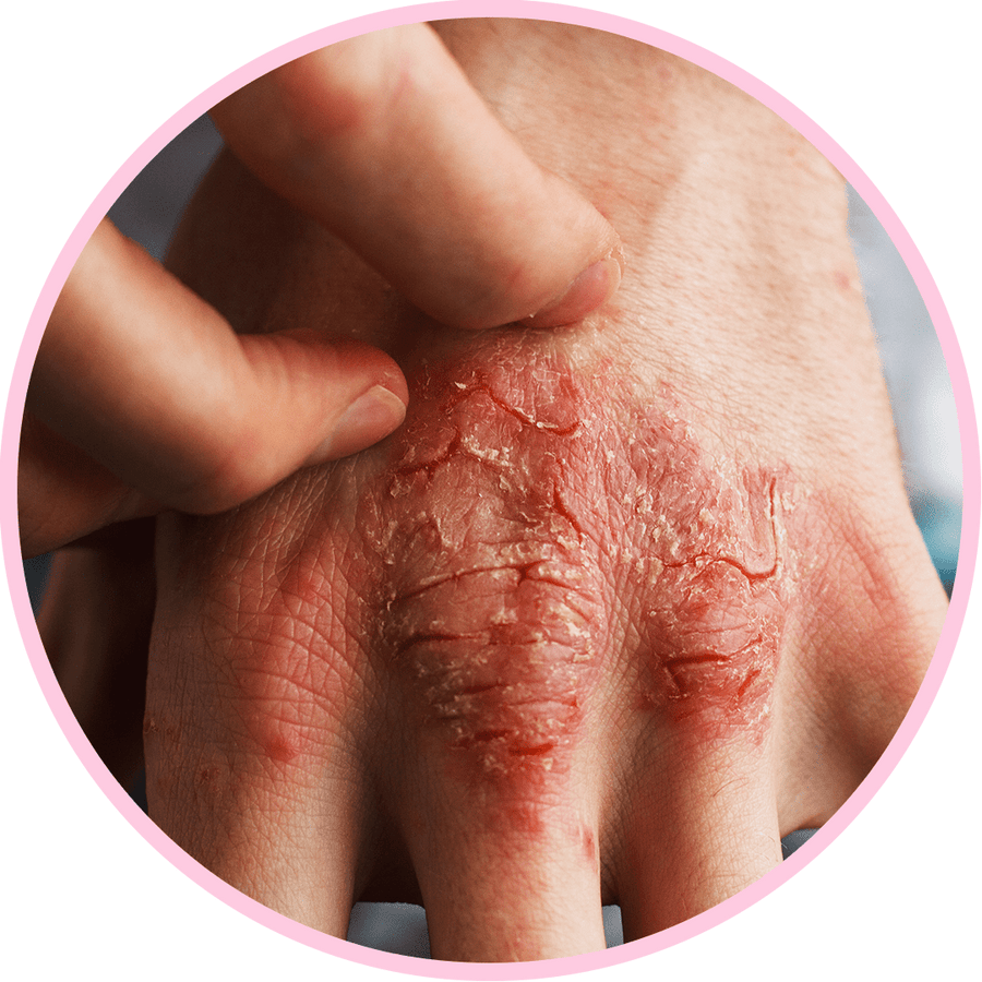 Delhicious - Award Winning Natural Skin Solutions